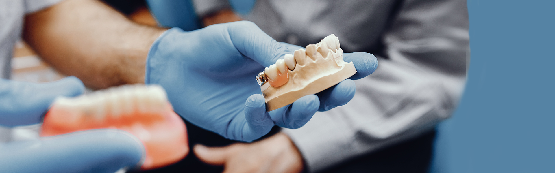 How to Care Best for Your Dental Bridge?: Tips for Longevity and Comfort